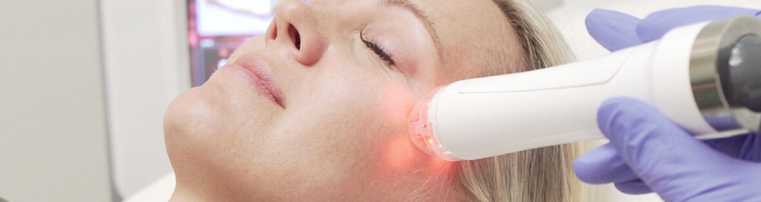 RF Needling Athlone – Urba Beauty